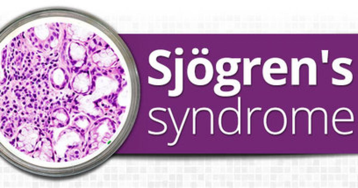 Sjogren?s Syndrome - Causes, symptoms and prevention all at Sani Dental ...