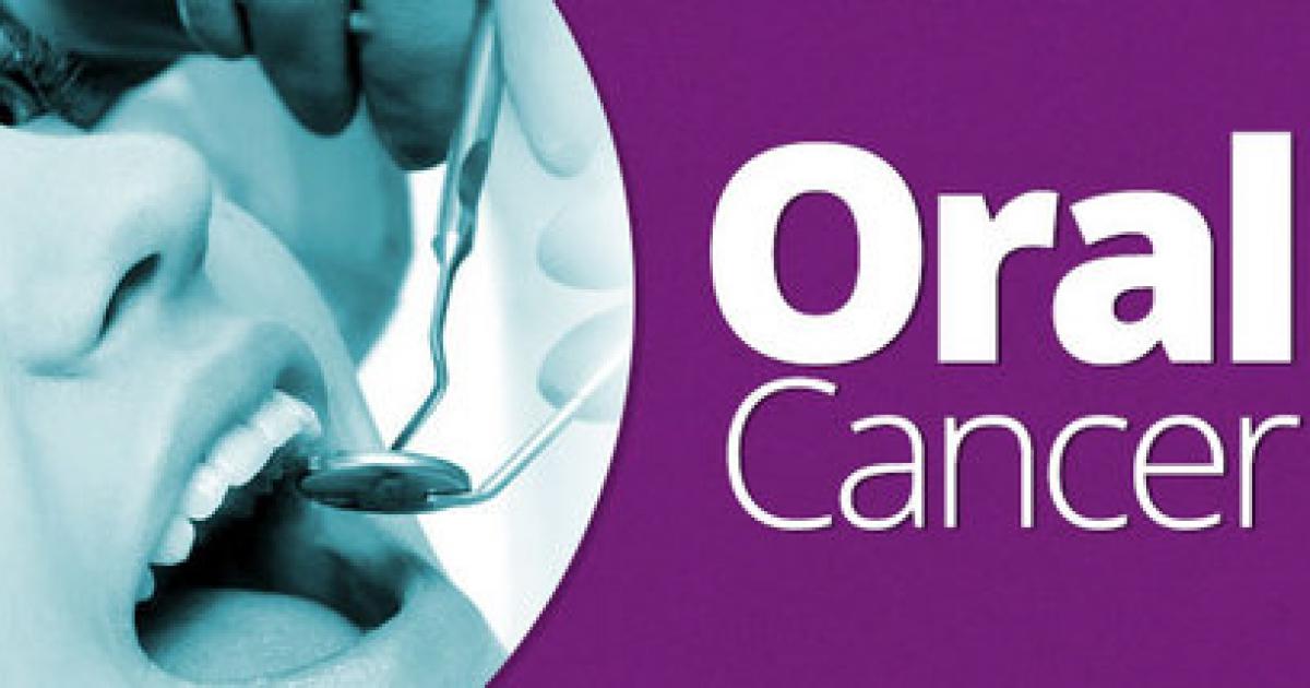 Oral Cancer Symptoms And Avoid The Disease Smoking Sani Dental Group