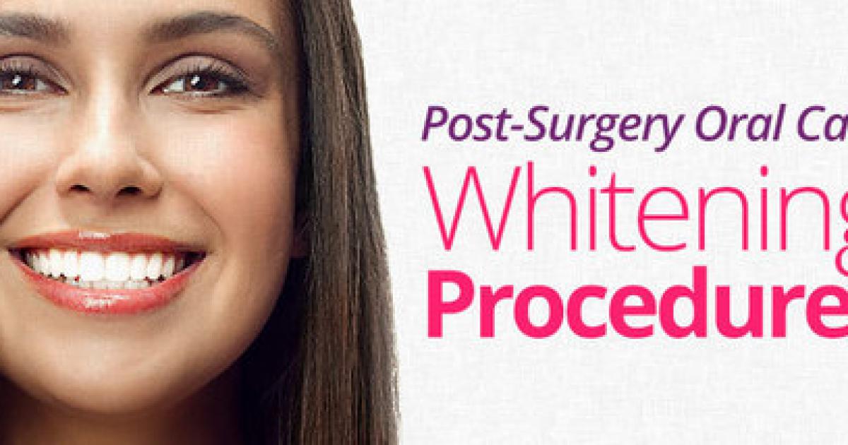 SDG offers tips to protect your teeth after a whitening procedure