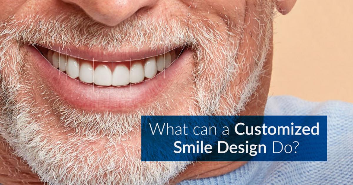What can a Customized Smile Design Do? #1 Dental Clinic in Mexico